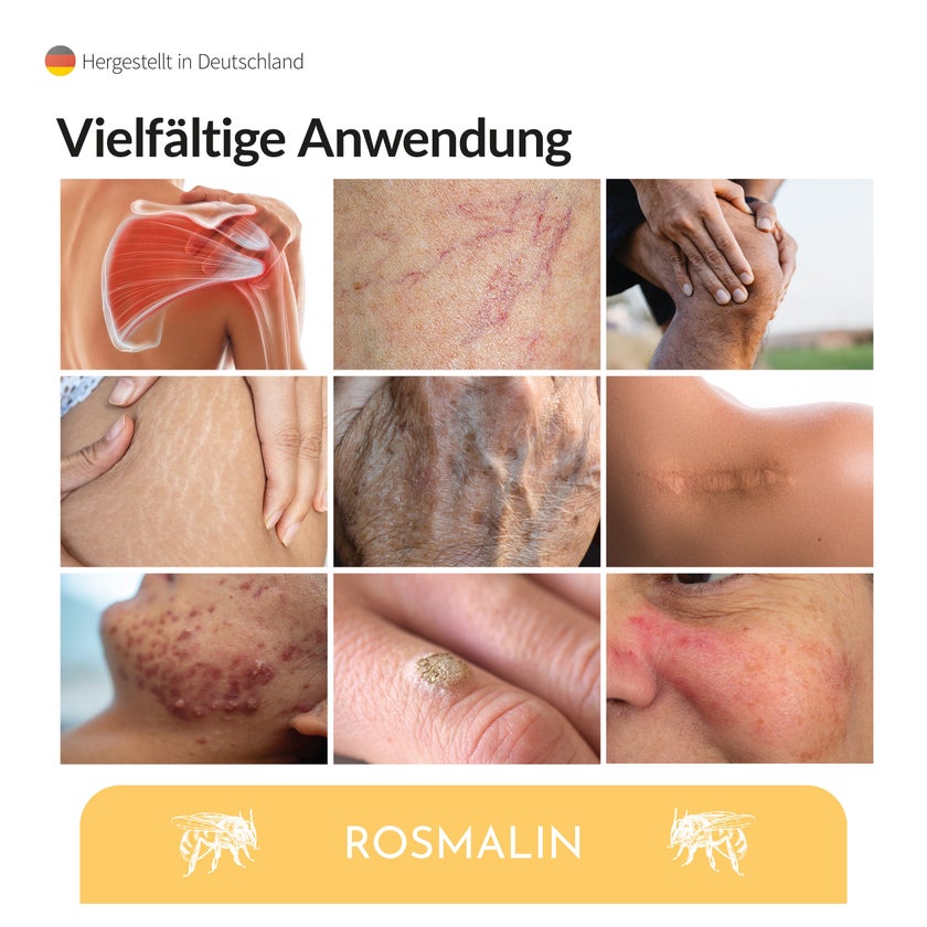 Rosmalin® Bienengiftsalbe - Bienengift Creme 100 ml günstig kaufen | medpex